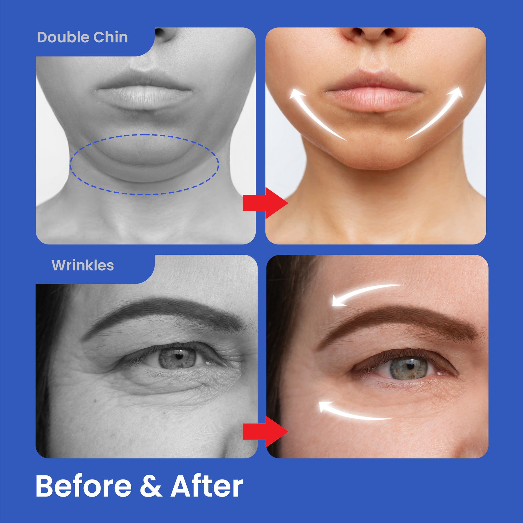 Invisible Face Lifting Tape – NURIVE